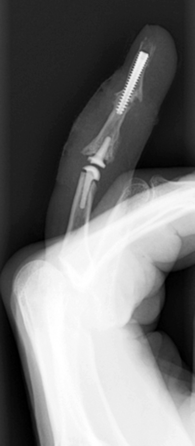 Joint Arthroplasty: a gallery