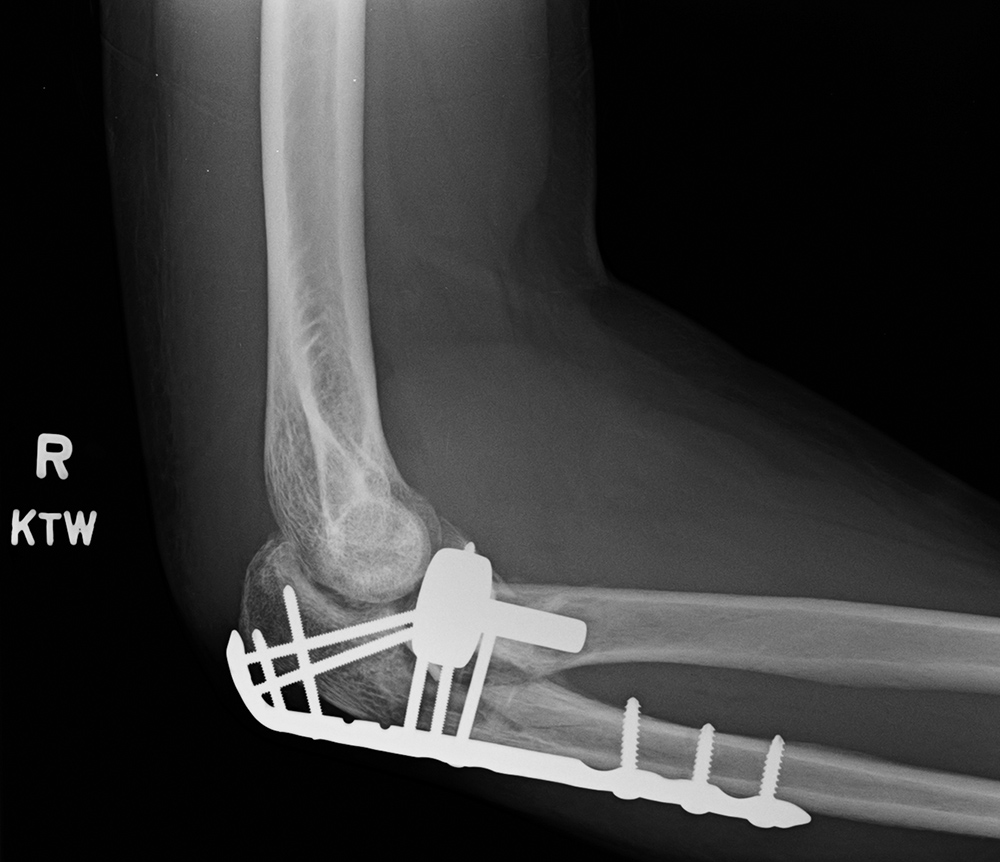 Medical Apparatus Imaging Guide: fracture fixation